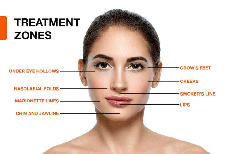 EZ Gel PRF PLATELET-RICH-FIBRIN – Rejuve Anti Aging Medical Spa in Franklin