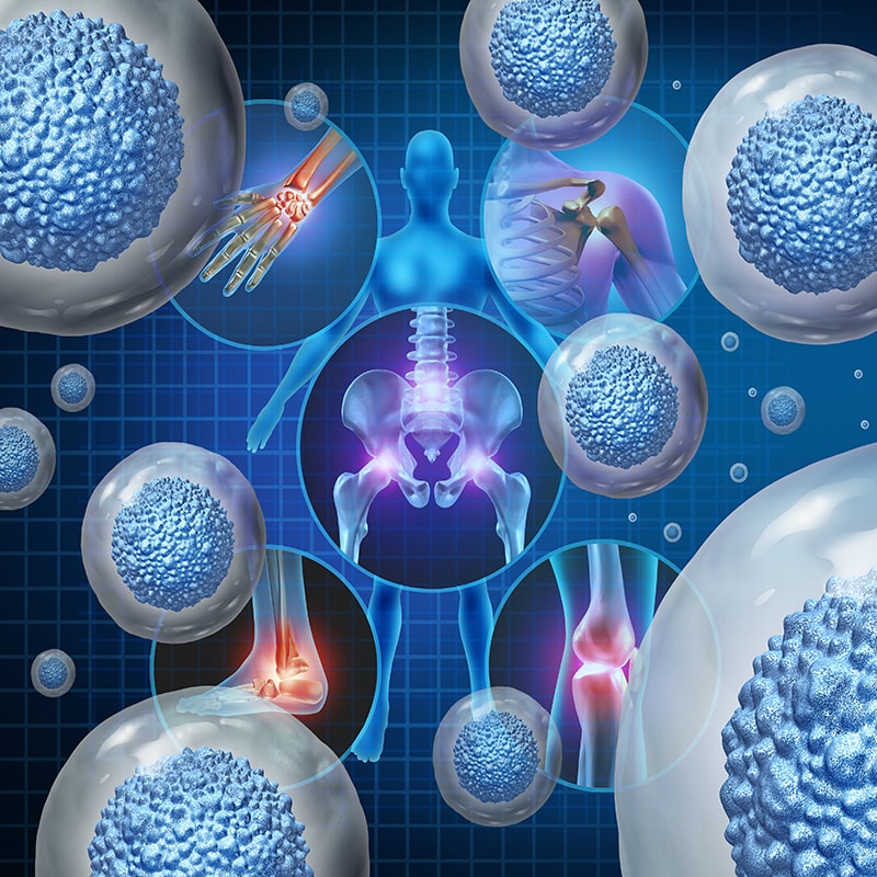 Stem Cell Joint Injections For Spine Pain – Rejuve Anti Aging Medical ...